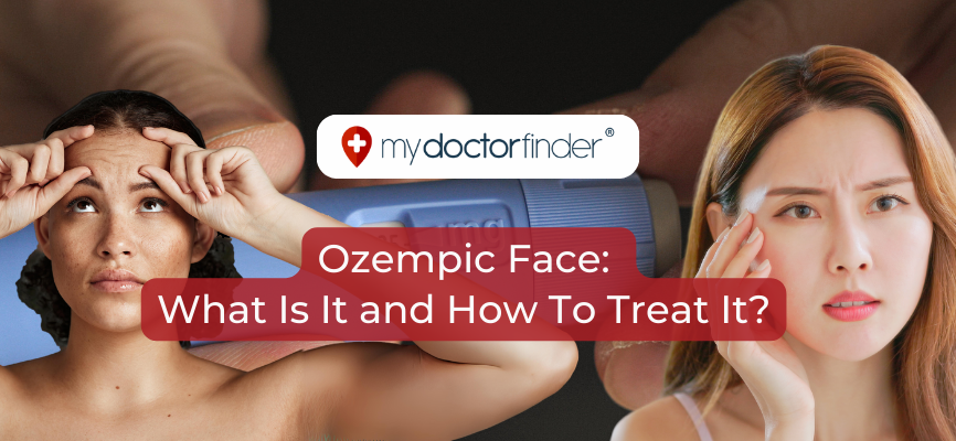 Ozempic Face: What Is It and How To Treat It?