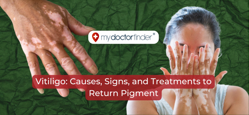 Vitiligo: Causes, Signs, and Treatments to Return Pigment