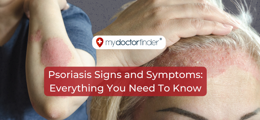 Psoriasis Signs and Symptoms: Everything You Need To Know